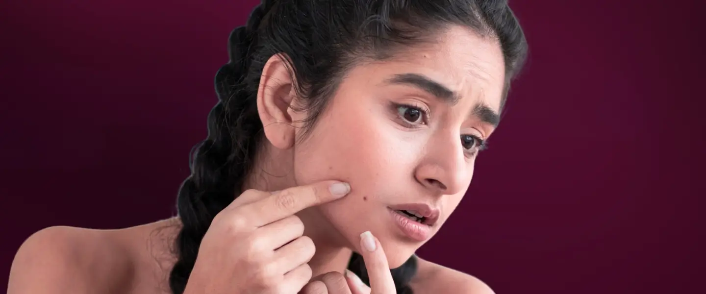 Tanda Kulit Iritasi: Berikut Ciri dan Cara Mengatasinya - 20Mefree